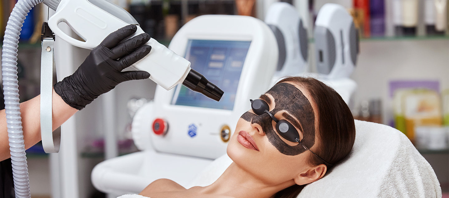 Peeling doux du visage par Carbon Laser - Realdeals.ch