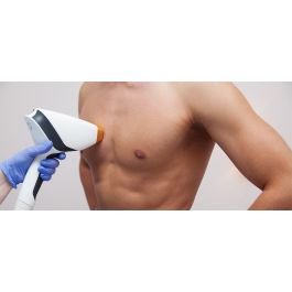 Épilation définitive au Laser Diodes pour homme - Zone au choix ...
